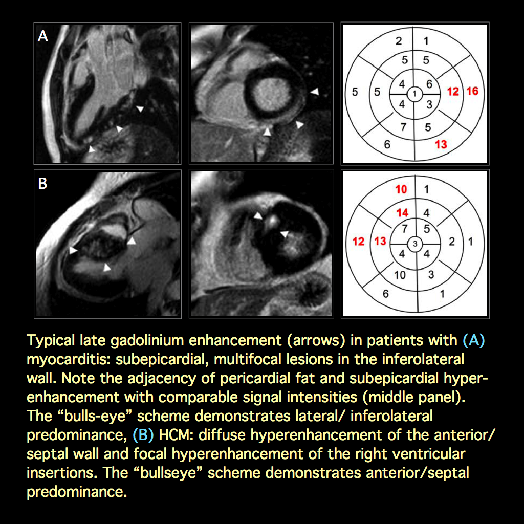 MRI BLOG: Imagery of Cardiac Pathology