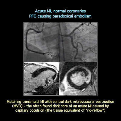 MRI BLOG: Imagery of Cardiac Pathology