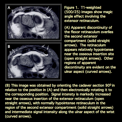MRI BLOG: Magic Angle Phenomenon