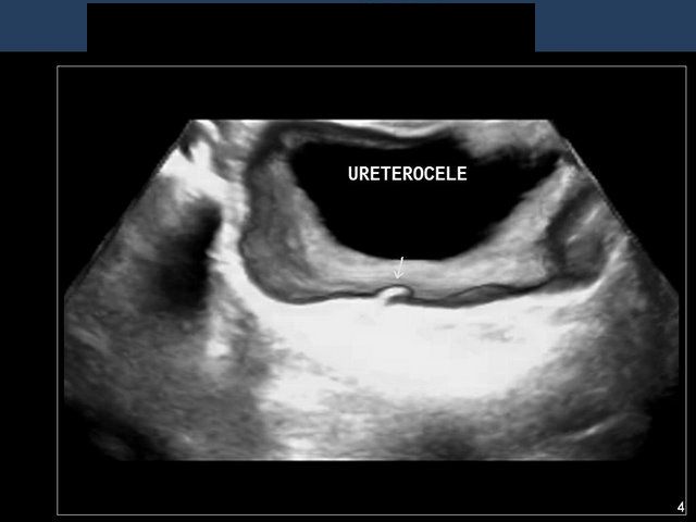 DOCTORS GATE.: 3- D ultrasound image WOW