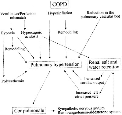 DOCTORS GATE.: RIGHT VENTRICULAR FAILURE IN COPD