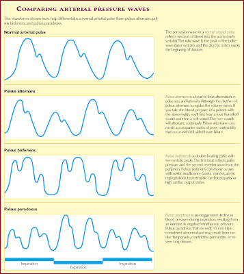 Doctors Gates: Shapes of Arterial pressure waves