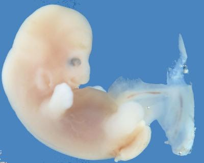 Queen For Blog: Fetus At 9 Weeks