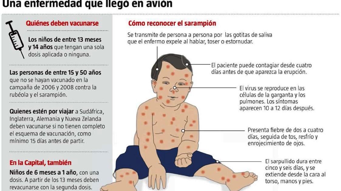 Centro Providencia red CONIN: Alerta nacional por casos de sarampión