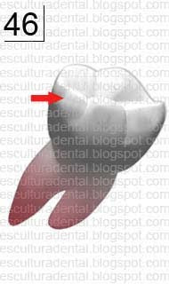 Cúspide distal do molar inferior