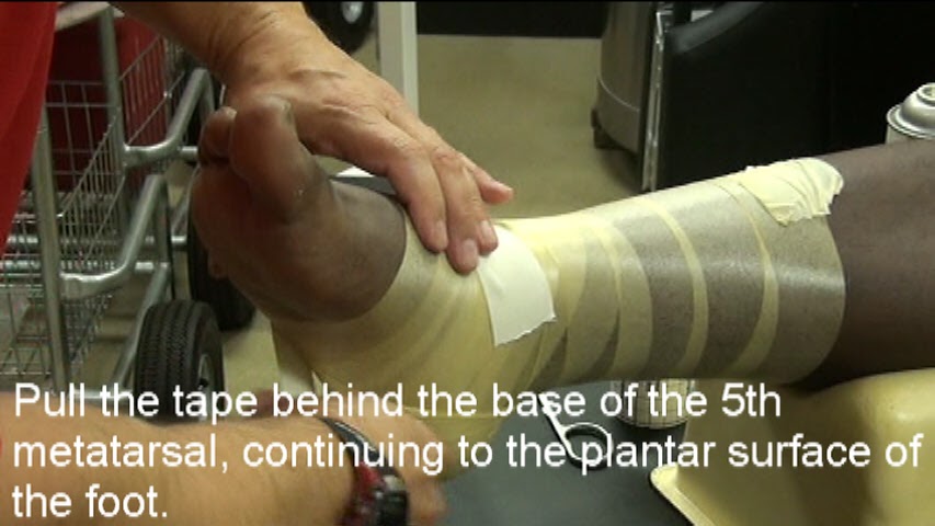 Dedicated to the High School Athletic Trainer: Taping for MTSS- The ...