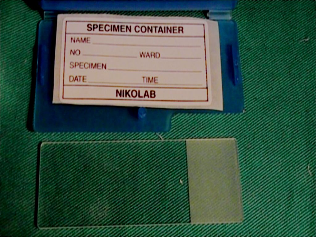 My Medical Notes: Pap Smear Technique