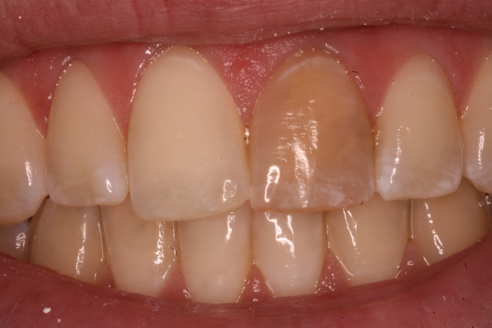 The Daily Grind: External Marketing