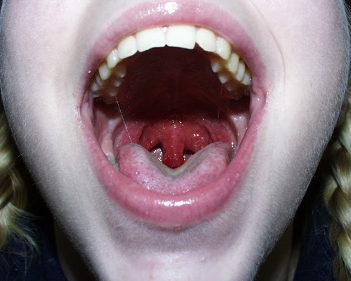Ma Blog Ma Life Throat