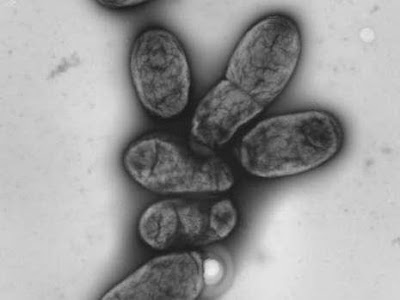 Lungenpest: Der „Schwarze Tod“ - So verbreitet sich die Pest