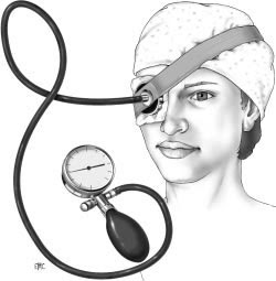 Taysir assistance الإسعاف الطبي تيسير: Compression oculaire avec un ...