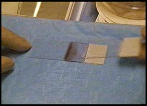 CARA PEMBUATAN PREPARAT DARAH TEPI - ilmu kesehatan