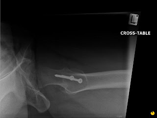 ICandy NZ: X-Ray Timeline