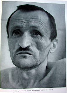 Dark Dissolution: Facies Dolorosa