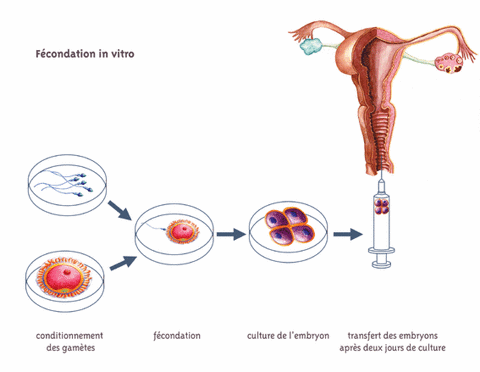 Fabriquer un bébé !: Les différents types de fécondation artificielle.