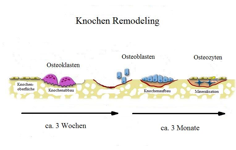 Osteoporose - Handeln bevor der Knochen bricht: Modeling und Remodeling