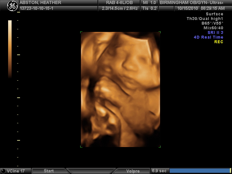 THE ABSTONS: Eli's 4D Ultrasound (30 weeks)