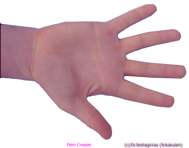 Emiti Enduku Ela ?(Telugu). ఏమిటి ? ఎందుకు ? ఎలా ?.: చేతుల్లో గీతలేంటి ...