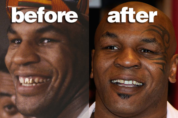 Imelda's Belog !: teeth!!