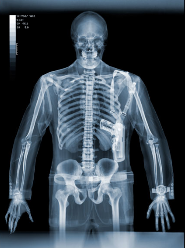 Ultimate Examples of X-Ray Photography by Nick Veasey | ~Spicx~