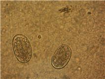EXAMEN COPROPARASITOSCOPICO
