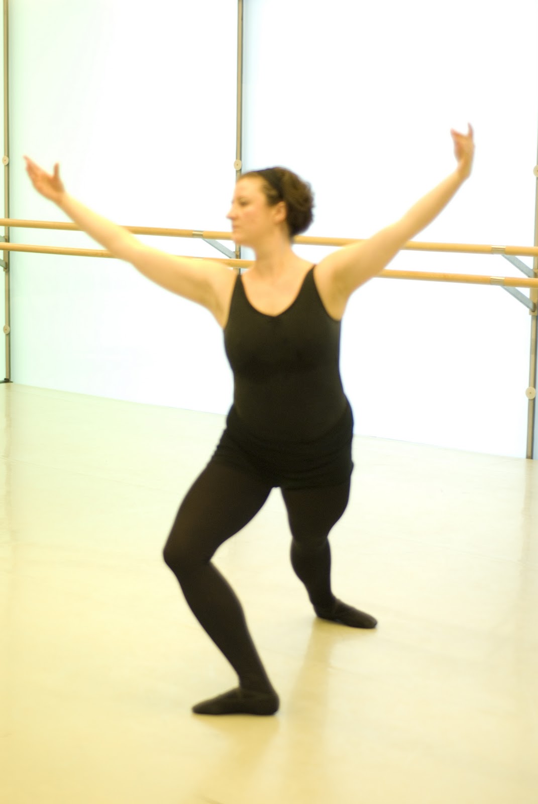 Dance Injury and Ehlers-Danlos Type III Hypermobility Syndrome: Ballet ...
