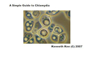A Family Doctor's Tale: A Family Doctor's Tale - CHLAMYDIA