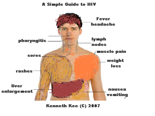 A Family Doctor's Tale: A Family Doctor's Tale - HIV