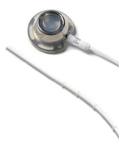 Esophagus Cancer: Meda-Port (Mediport) Installation