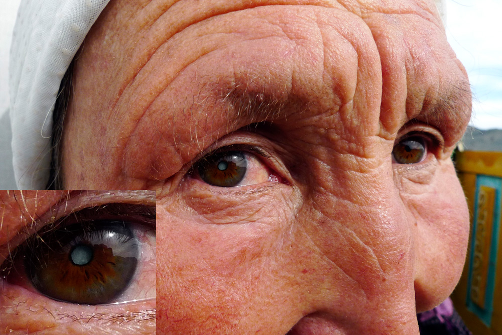 Mongolian eyes