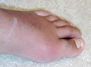 mykng: Someone, Please Cut Off My Left Foot