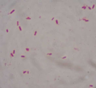 The Lab Freaks: Testing on Escherichia coli