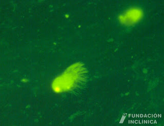 Microscopía Ultravioleta