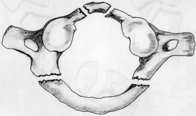 Previous Medical PostGraduation Entrance Papers' Mcqs with Answers: 407 ...