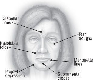 reneemulrooneybiol3500: The Lips (Labia)