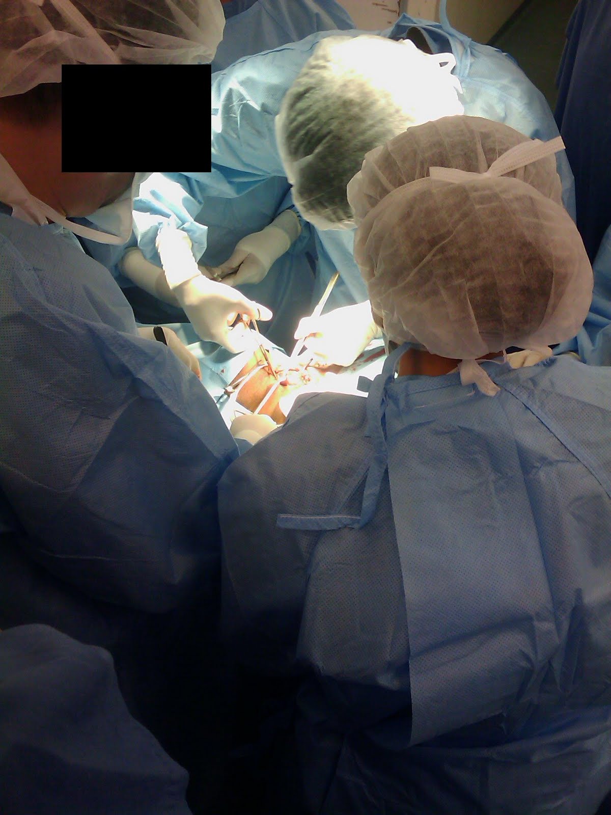 Journey of A Medie: On the Bloody Surgery