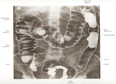 sanuscomplexus: Colon, descripción anatómica