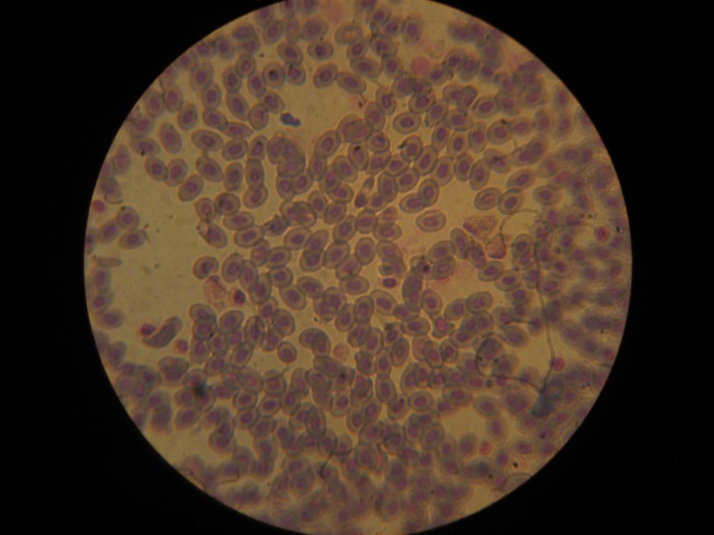 TuttyFrUiTyMixture.blogspot.com: chicken rbcs(red blodd cells of ...