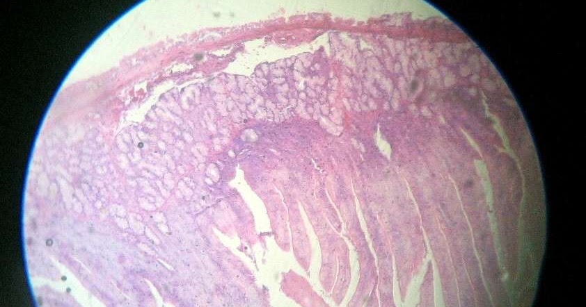 Histology Slides Database: Duodenum histology slide