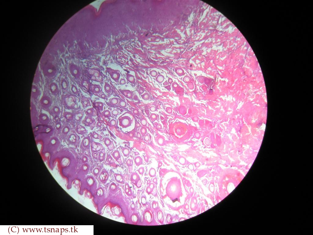 Histology Slides Database: human LIP histology slides