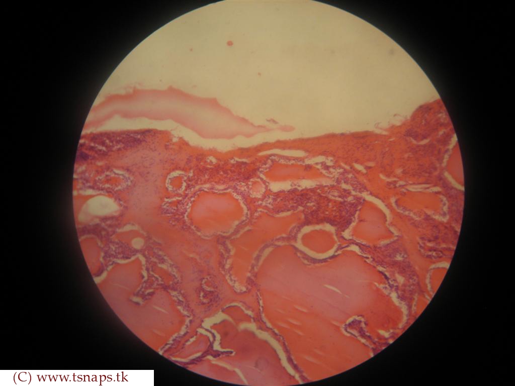 Histology Slides Database: thyroid gland histology slides
