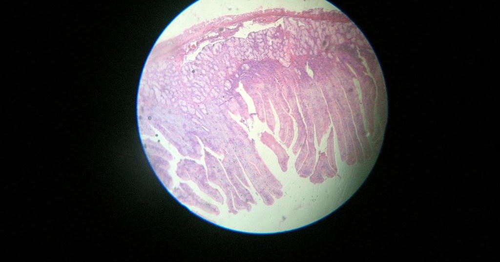 Normal Duodenum Histology