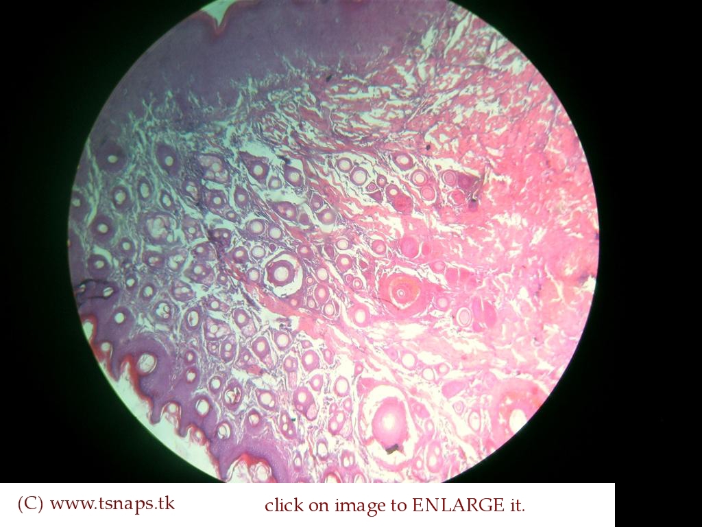 Histology Slides Database: human lip histology slides