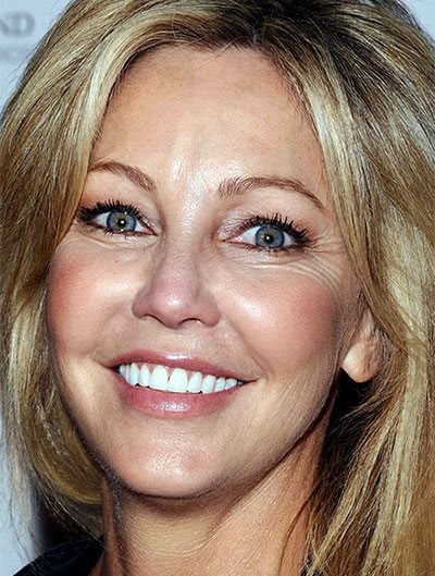 Ichik Ichik Ehem: Heather Locklear Plastic Surgery