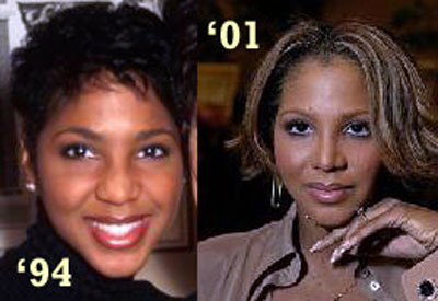 Toni Braxton Before And After
