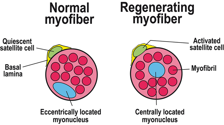Minutes to Muscles: Hipertrofia e Estimulo de Células Satélites