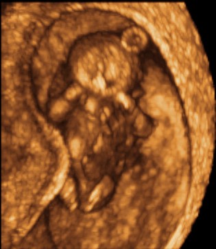 Mi nueva vida: La semana 10