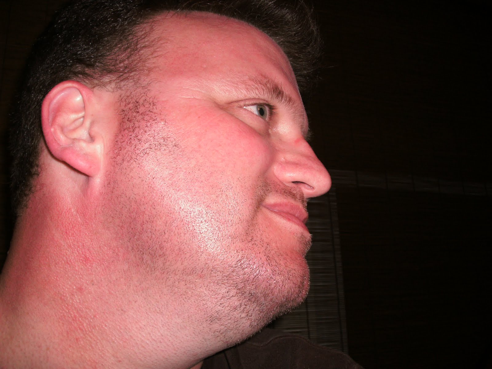 Adjusting To It: Off Day - Florida - and Bum Face