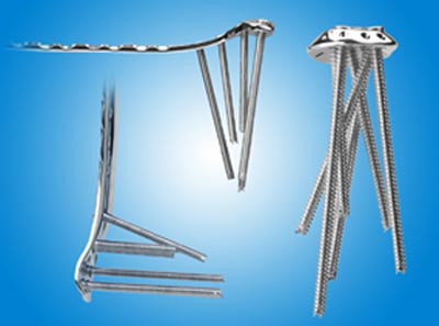 KITTY MEDICOS: Zimmer® Periarticular Locking Plate System