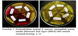 Analis Poenya Kendari: “ ISOLASI DAN IDENTIFIKASI BAKTERI ...